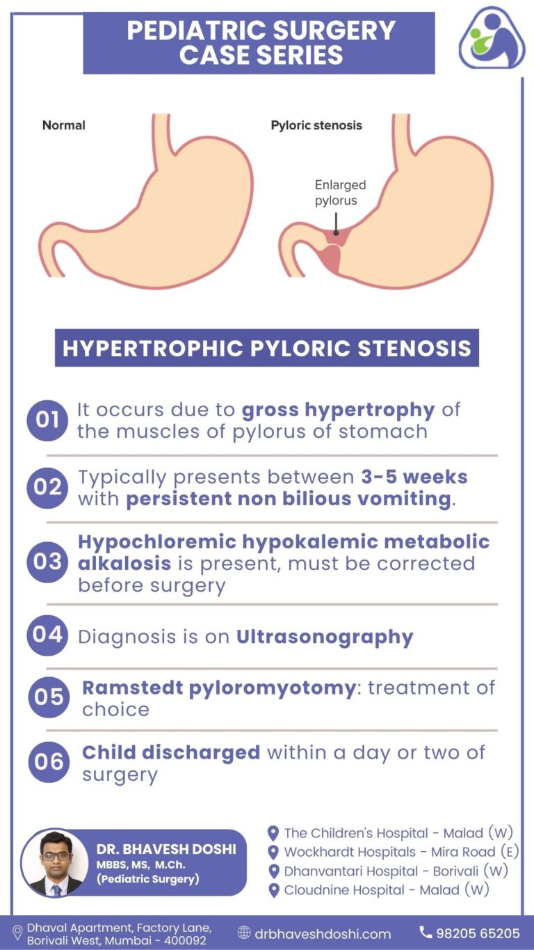 Infantile Hypertrophic Pyloric Stenosis - Dr. Bhavesh Doshi