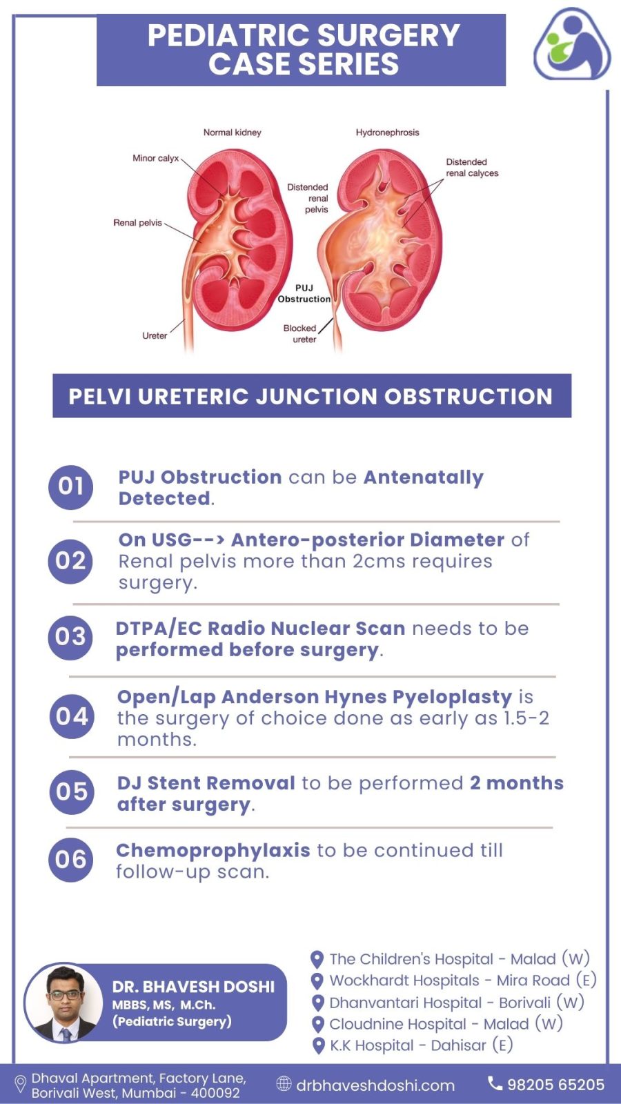 Pelviureteric Junction Obstruction