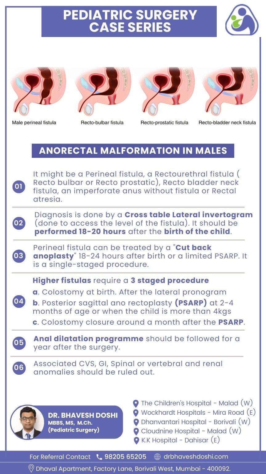 Anorectal Malformation - Dr. Bhavesh Doshi