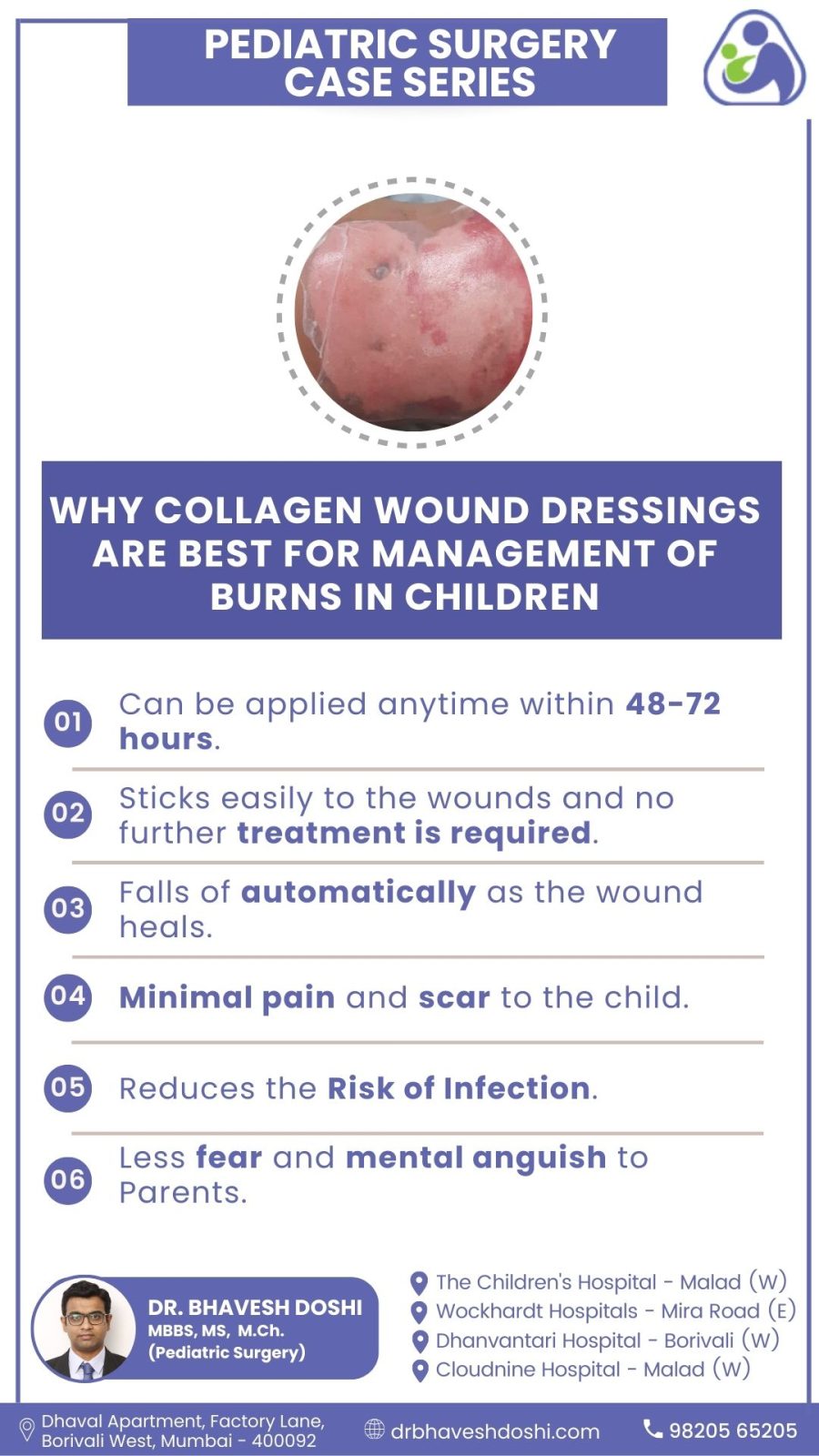 Why Collagen Wound Dressings Are Best For Management Of Burns In Children